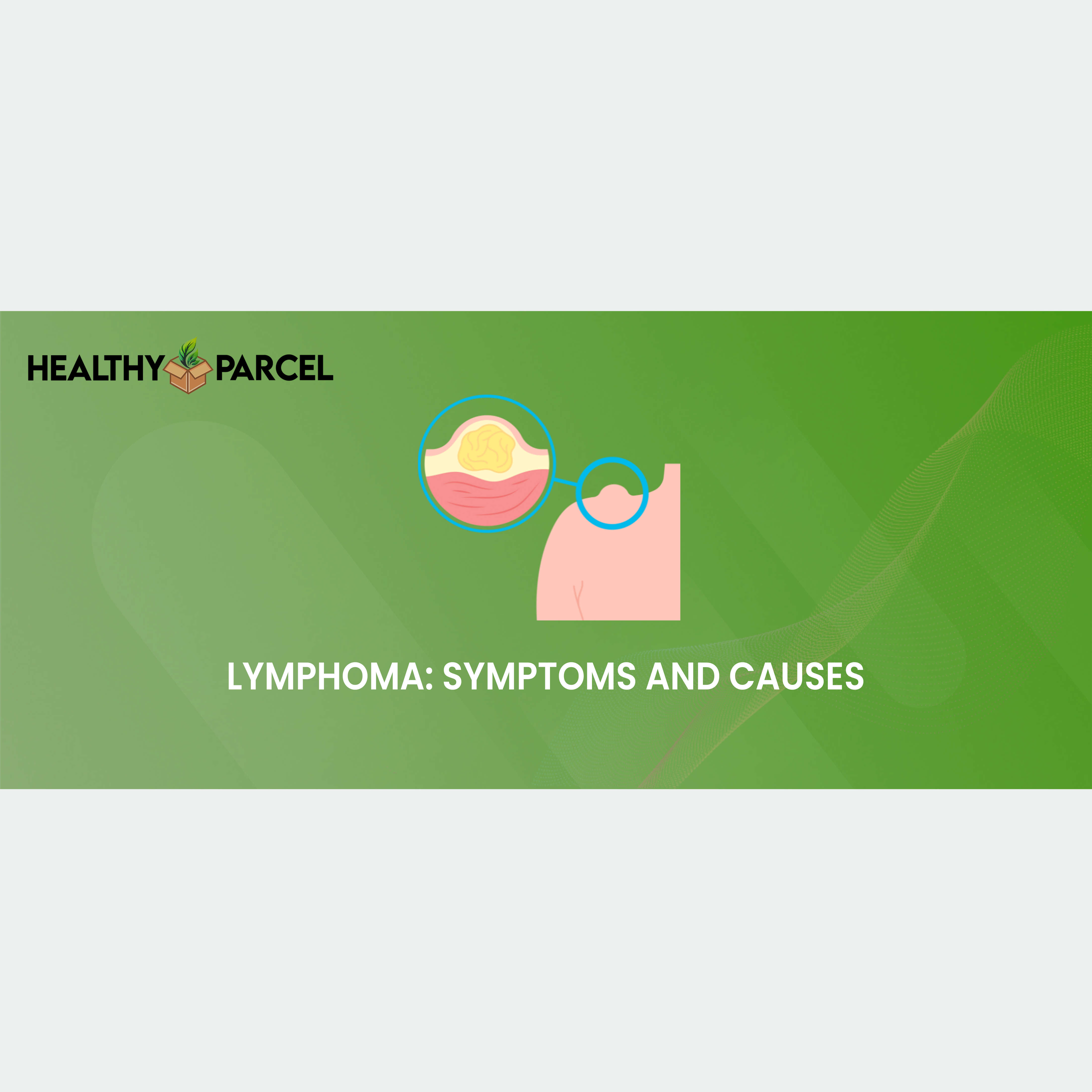 Lymphoma: Symptoms and Causes